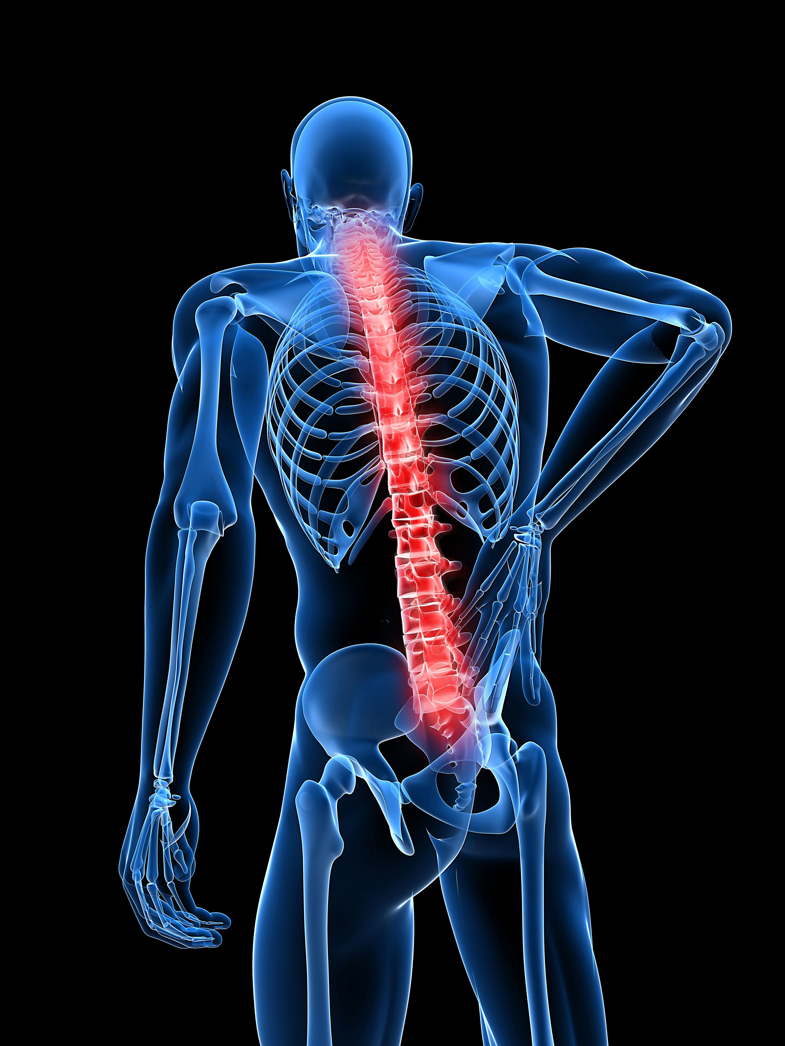 Back Pain : What to do for Acute Pain? - Saanich Physio + Sports Clinic